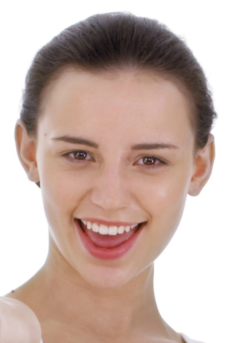Face Mapping - What Do Your Spots Mean? | T Zone